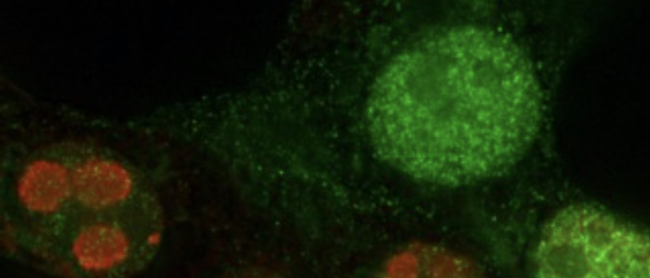 wu.lab.uiowa.edu | The University of Iowa