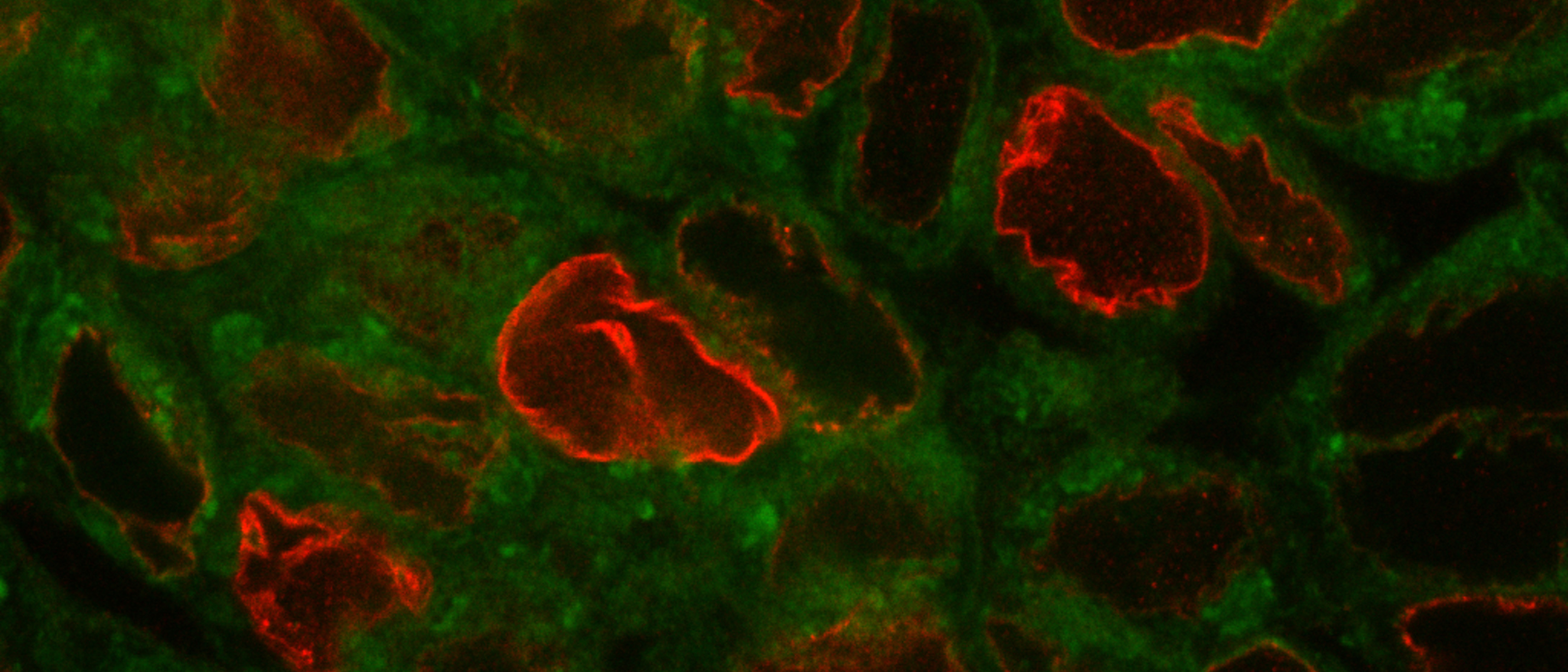 wu.lab.uiowa.edu | The University of Iowa